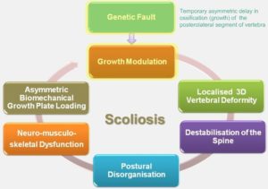 Vicious-Cycle-of-Scoliosis - Scoli-Fit | Non-surgical Scoliosis ...